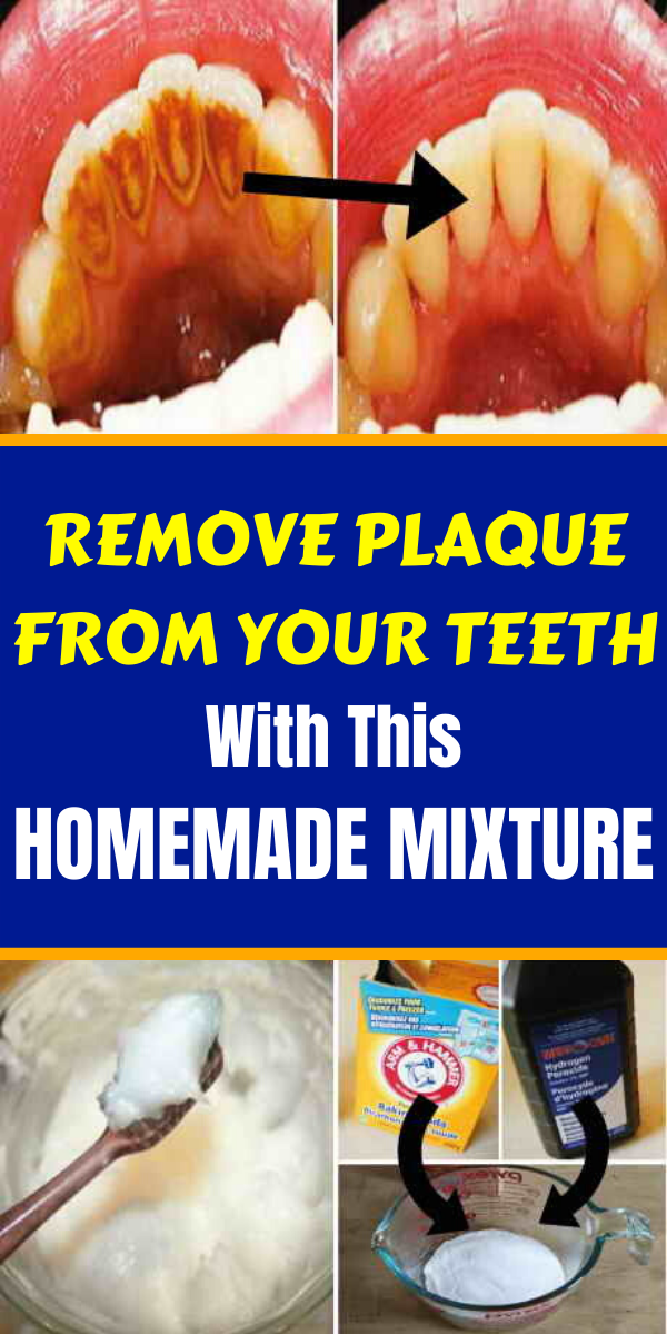 Wellness Tips Remove Plaque From Your Teeth With This Homemade Mixture wellness-tips-remove-plaque-from-your-teeth-with-this-homemade-mixture