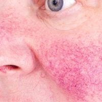 Les dommages causés à la peau par l'application du maquillage expiré