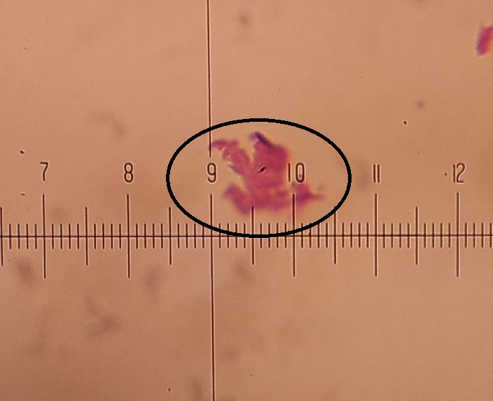 IBG Lab Report: LAB 2: MEASUREMENT AND COUNTING OF CELLS USING MICROSCOPE