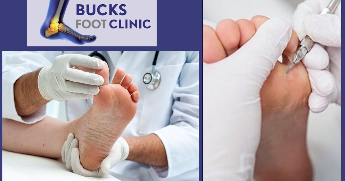 Know Everything About General Podiatry