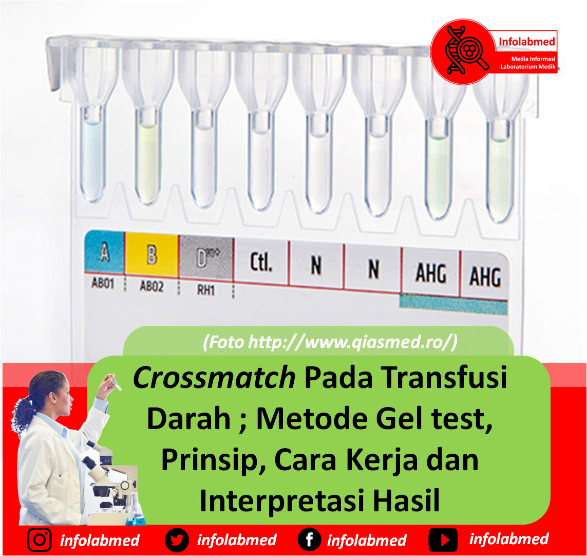 Crossmatch Pada Transfusi Darah ; Metode Gel test, Prinsip, Cara Kerja ...