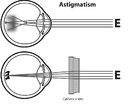 The Science Week: Defects Of Vision- Simplified Notes