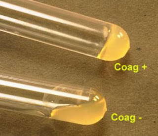 COAGULASE TEST - Microbiology Laboratory Turkey