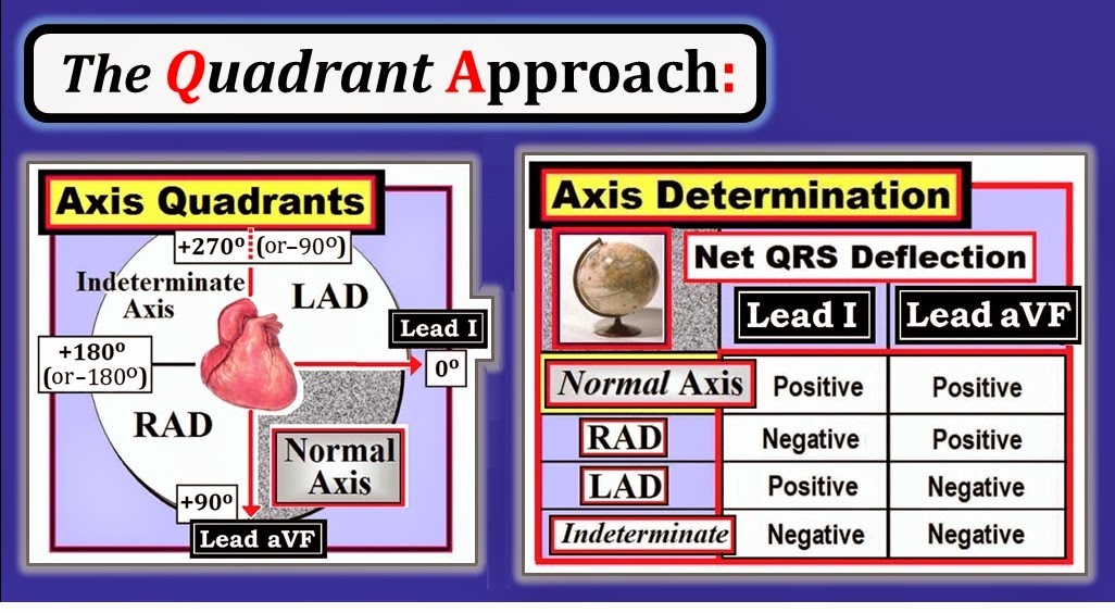 Normal ECG & electrocardiography principles (정상심전도) : 네이버 블로그