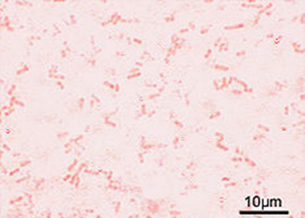 Membangun Kesehatan Hewan Untuk Kesehatan Manusia: SHIGELLOSIS ...
