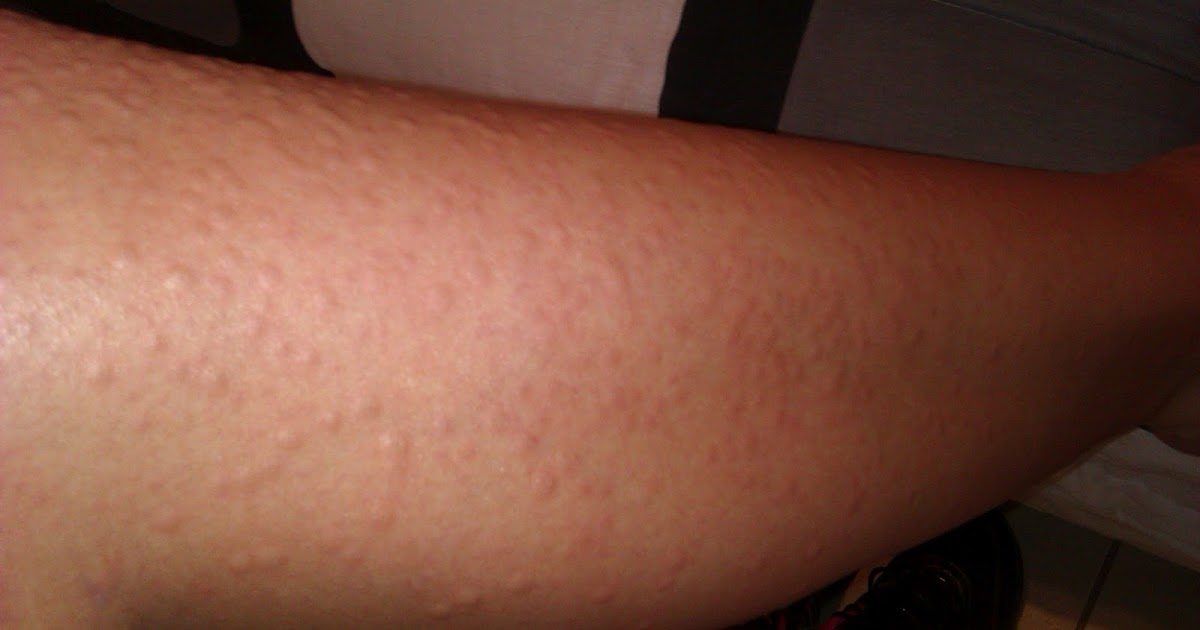 Waxing Before And After Arms