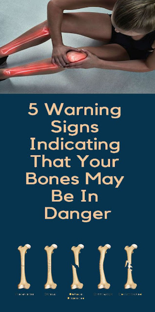5 Warning Signs Indicating That Your Bones May Be In Danger | Healthy Tray