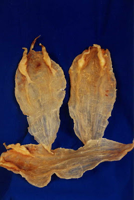 Some Dried Fish Maw Pictures - Alfa Enterprises (PVT) Ltd. Welcome to ...