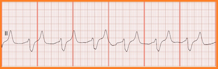 Practice EKG Rhythm Strips 199