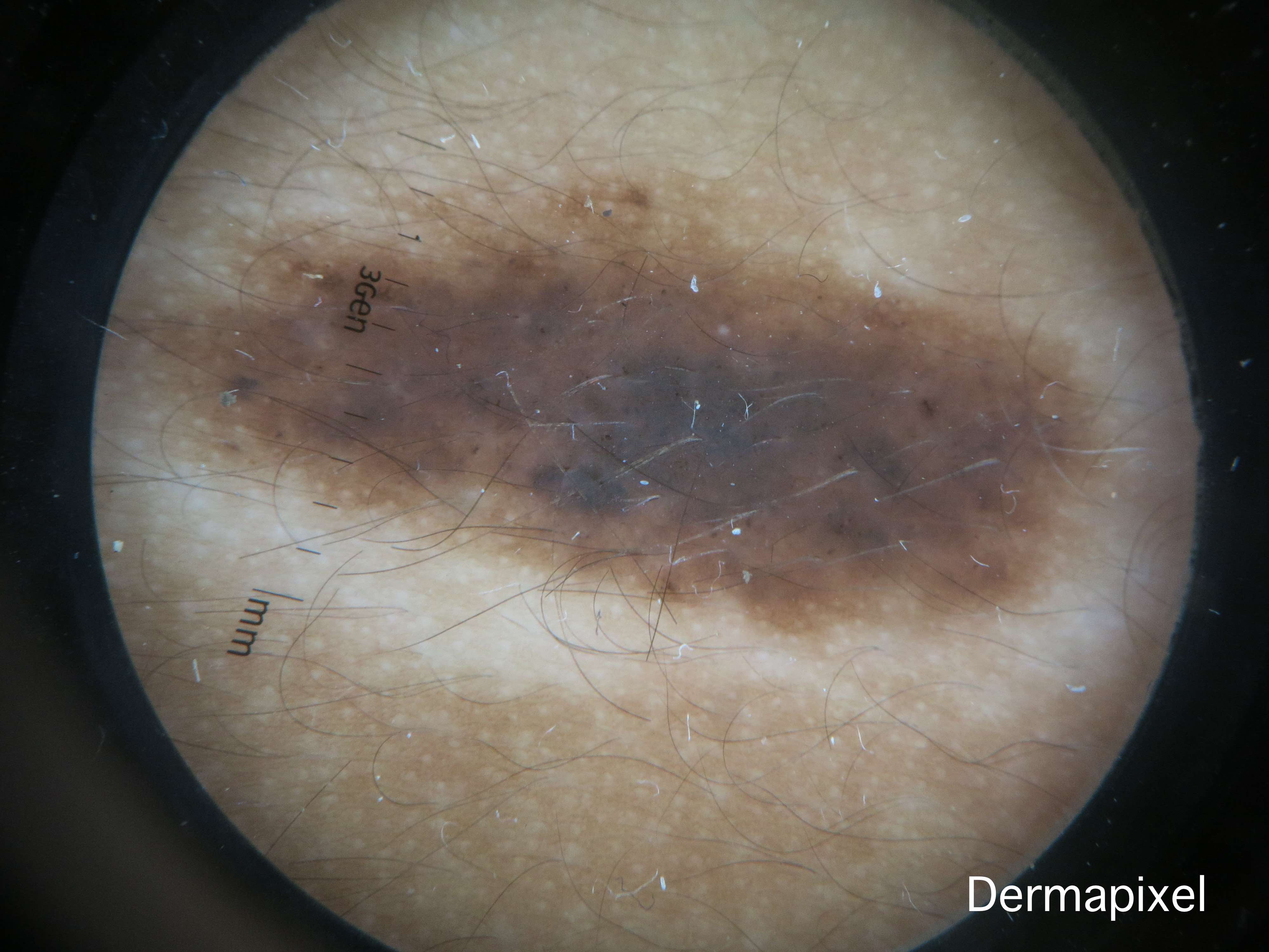 Dermapixel: junio 2021