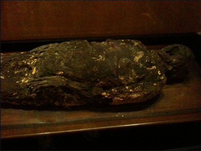 Soap Woman Mutter Museum