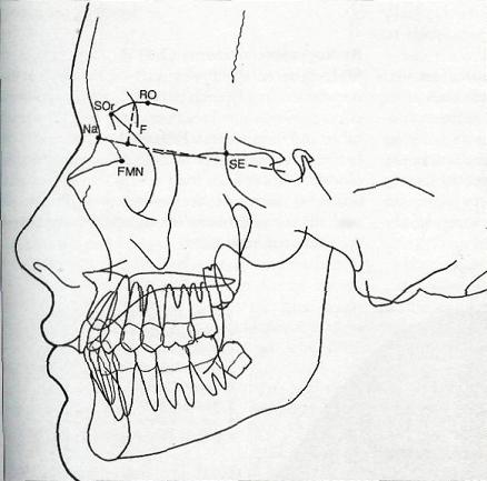 Dentistry lectures for MFDS/MJDF/NBDE/ORE: Note on Radiographic Anatomy ...