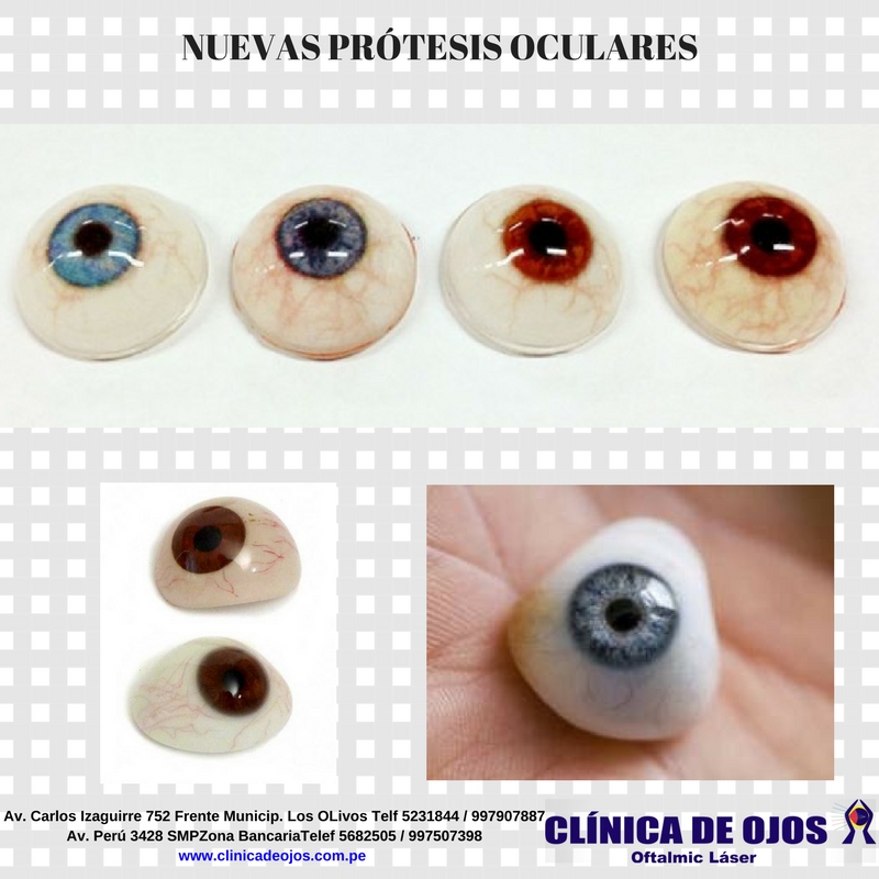 Clínica de Ojos Oftalmic Láser: NUEVAS PRÓTESIS OCULARES