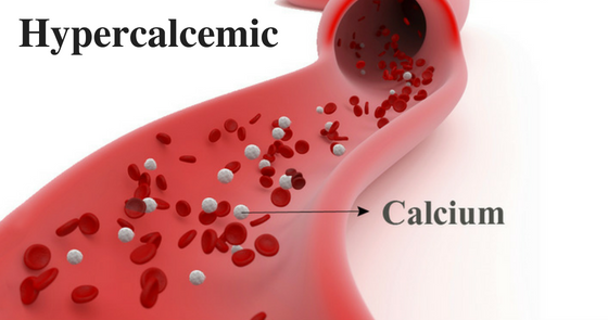 Hypercalcemic Crisis: Symptoms and Complications