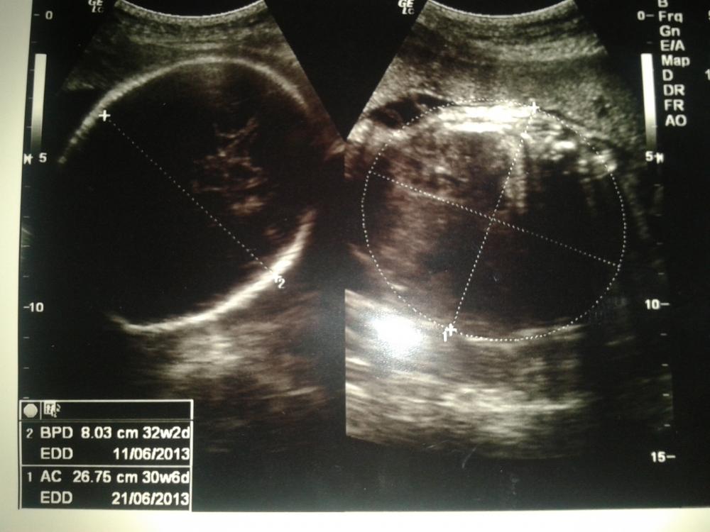 USG 4 DIMENSI: Lengkap Tentang USG 2 Dimensi, 3 Dimensi dan 4 Dimensi