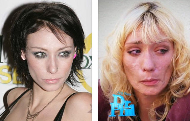 Une future top model devenue junkie - L'assurance d'une vie meilleure ...