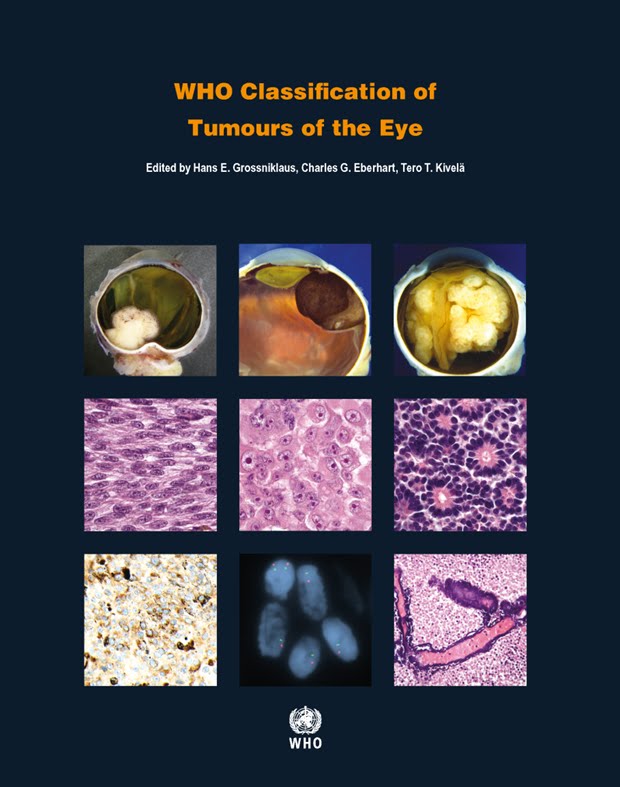 neuropathology blog: The new WHO Ocular Tumour “Blue Book” is now ...
