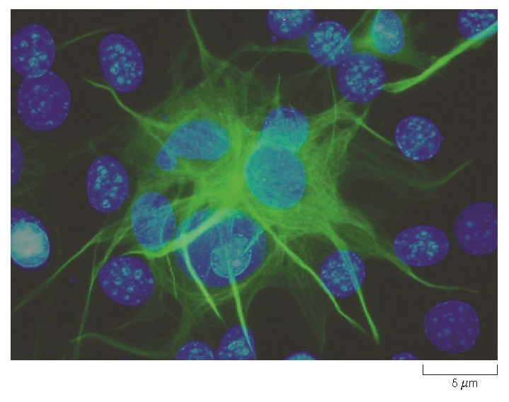FLUORESCENCE MICROSCOPY and GFP - pediagenosis