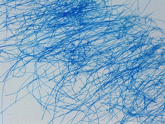 Fun With Microbiology (What's Buggin' You?): Trichophyton tonsurans