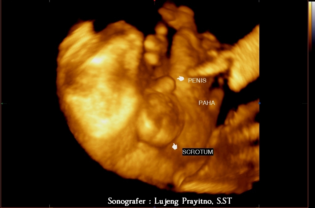 Teknik USG 4 Dimensi