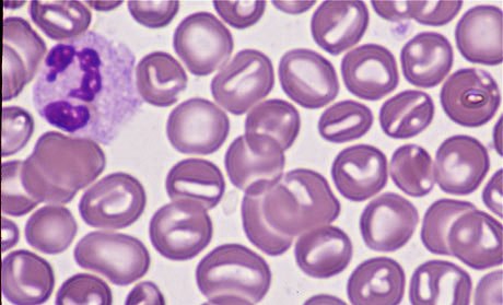 Sel Darah Merah Atau Lebih Dikenal Sebagai Eritrosit Memiliki Fungsi ...