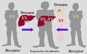Pros y contras ~ Trasplantes de órganos