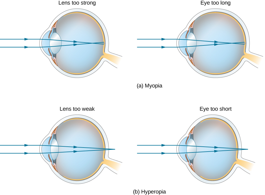 Human Eye CBSE NOTES 2021 human-eye-cbse-notes-2021