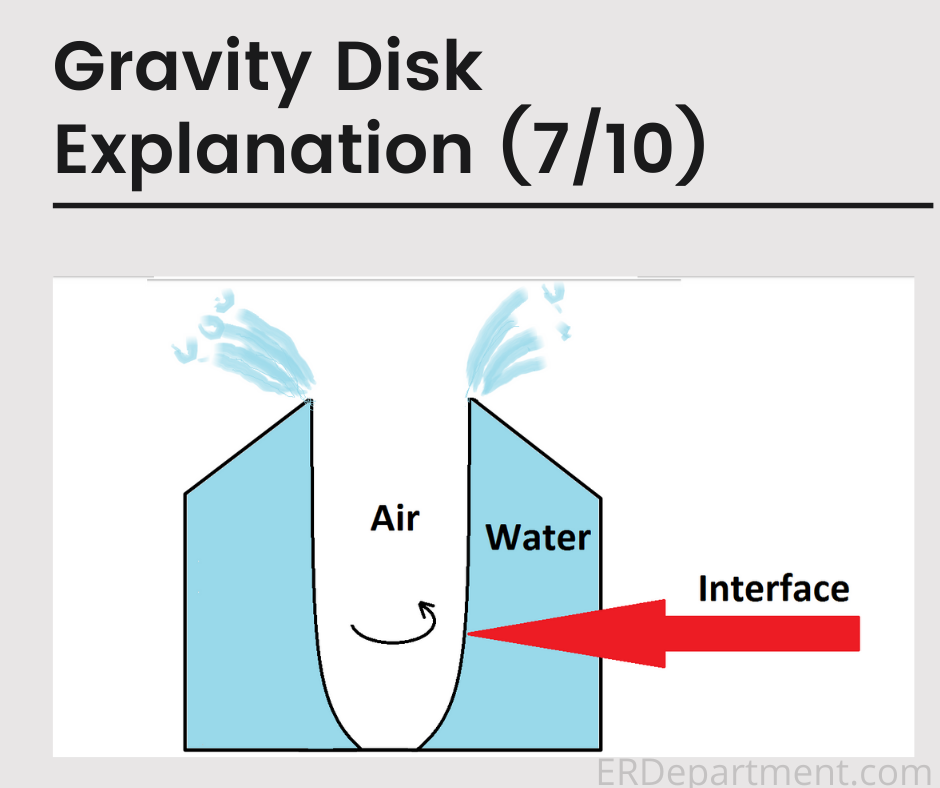 Best ways to select purifier gravity disk | A Complete Guide