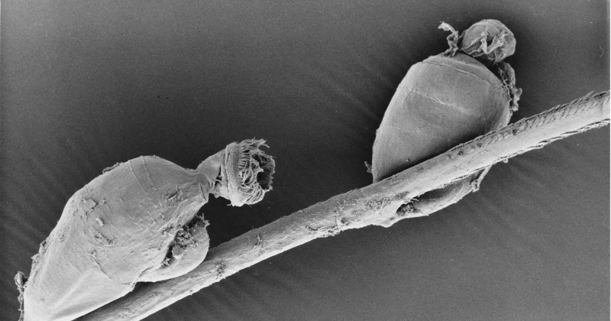 Real Monstrosities: Symbion