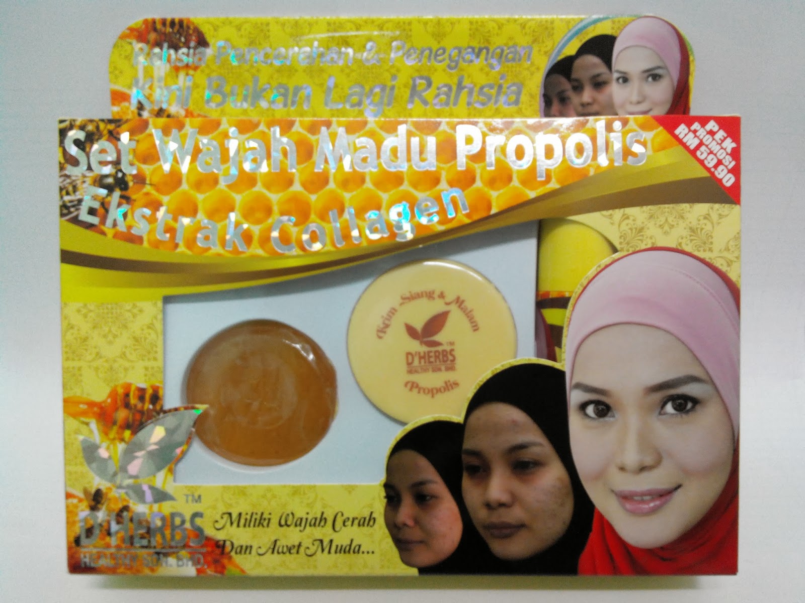 Cara Memutihkan Kulit Muka dan Cara Menghilangkan Bekas Jerawat: Produk ...