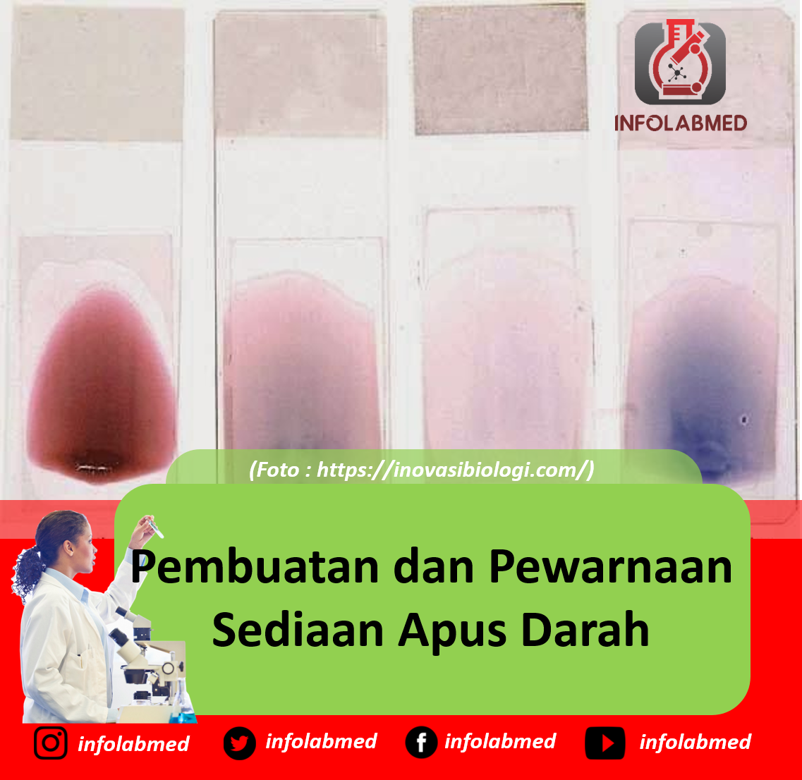Pembuatan dan Pewarnaan Sediaan Apus Darah