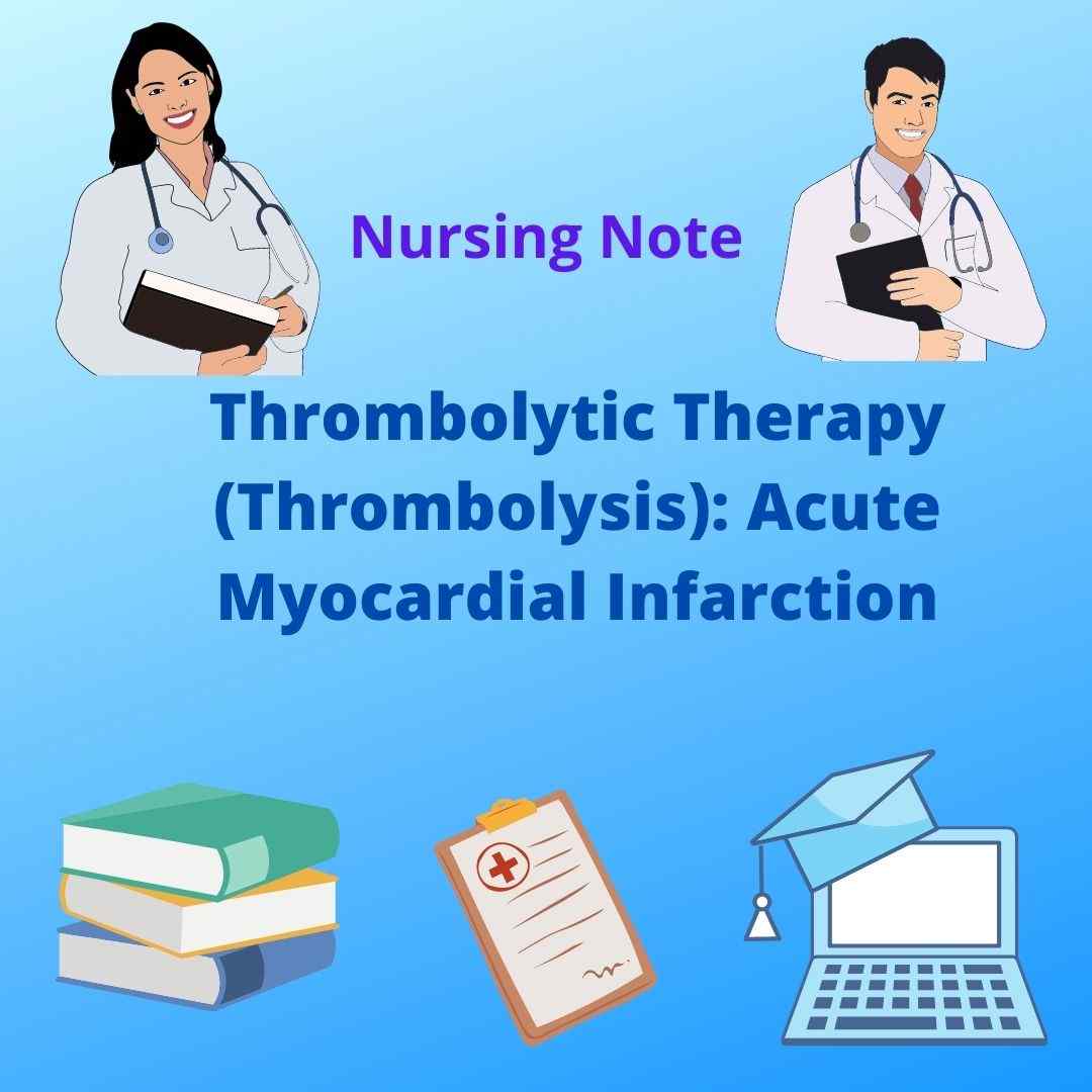 Thrombolytic Therapy (Thrombolysis): Acute Myocardial Infarction ...