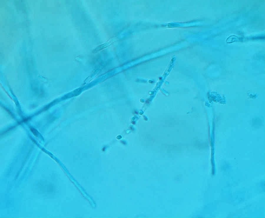 ATLAS MICOLOGIA: TRICHOPHYTON VERRUCOSUM