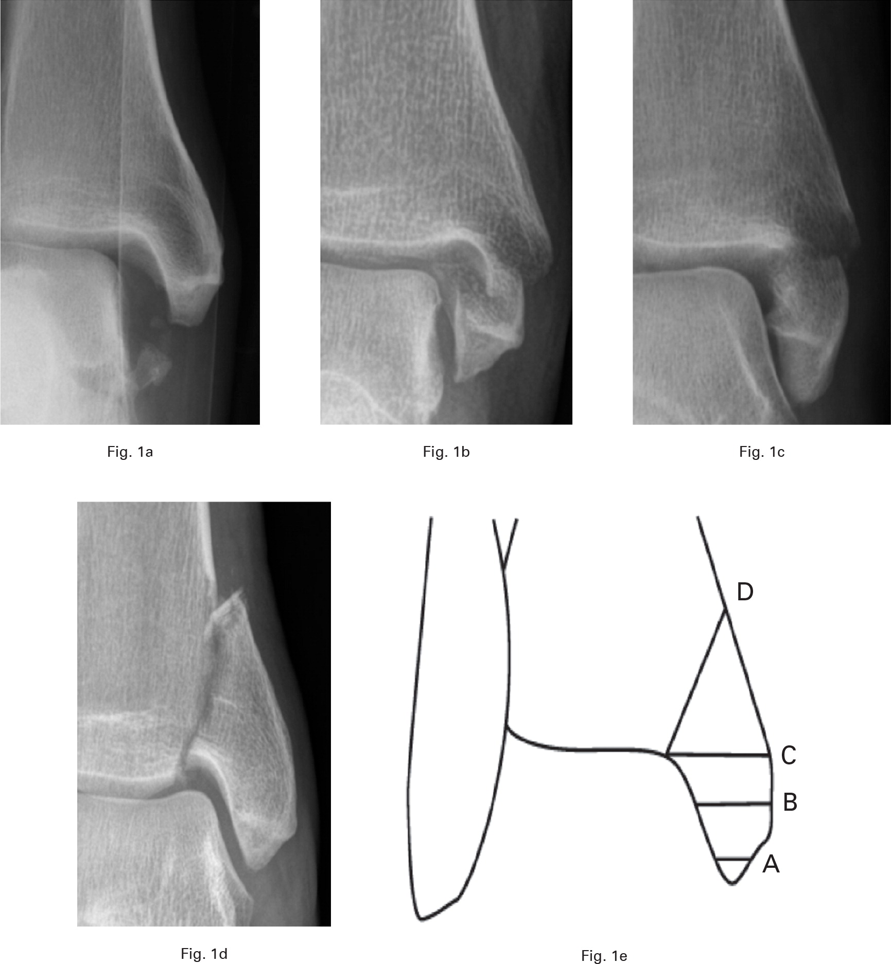 Revisiones_bibliográficas TyO_Web: 21/02/21 - 28/02/21
