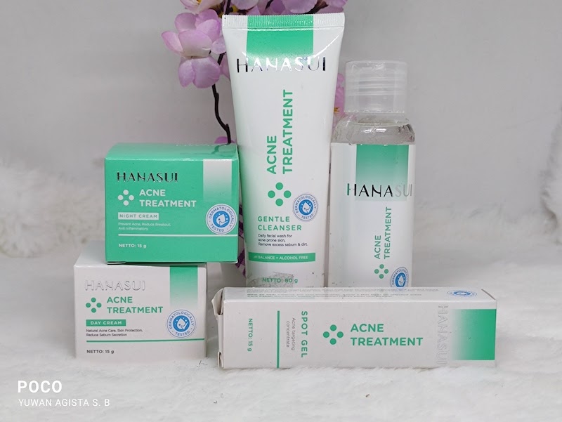 Review Hanasui Acne Treatment Series - Kisah Foto