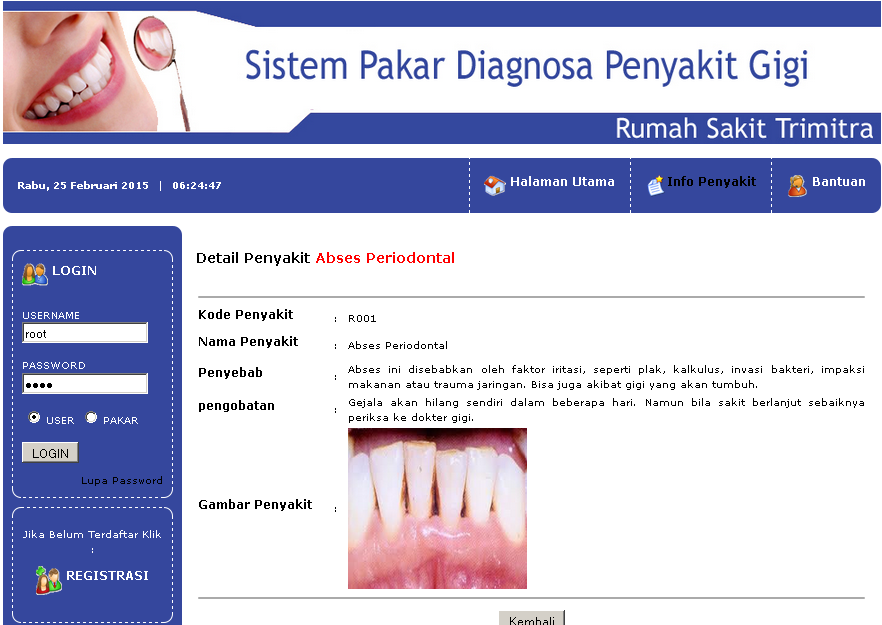 Aplikasi sistem pakar diagnosa penyakit gigi metode fordward chaining ... Aplikasi sistem pakar diagnosa penyakit gigi metode fordward chaining ...