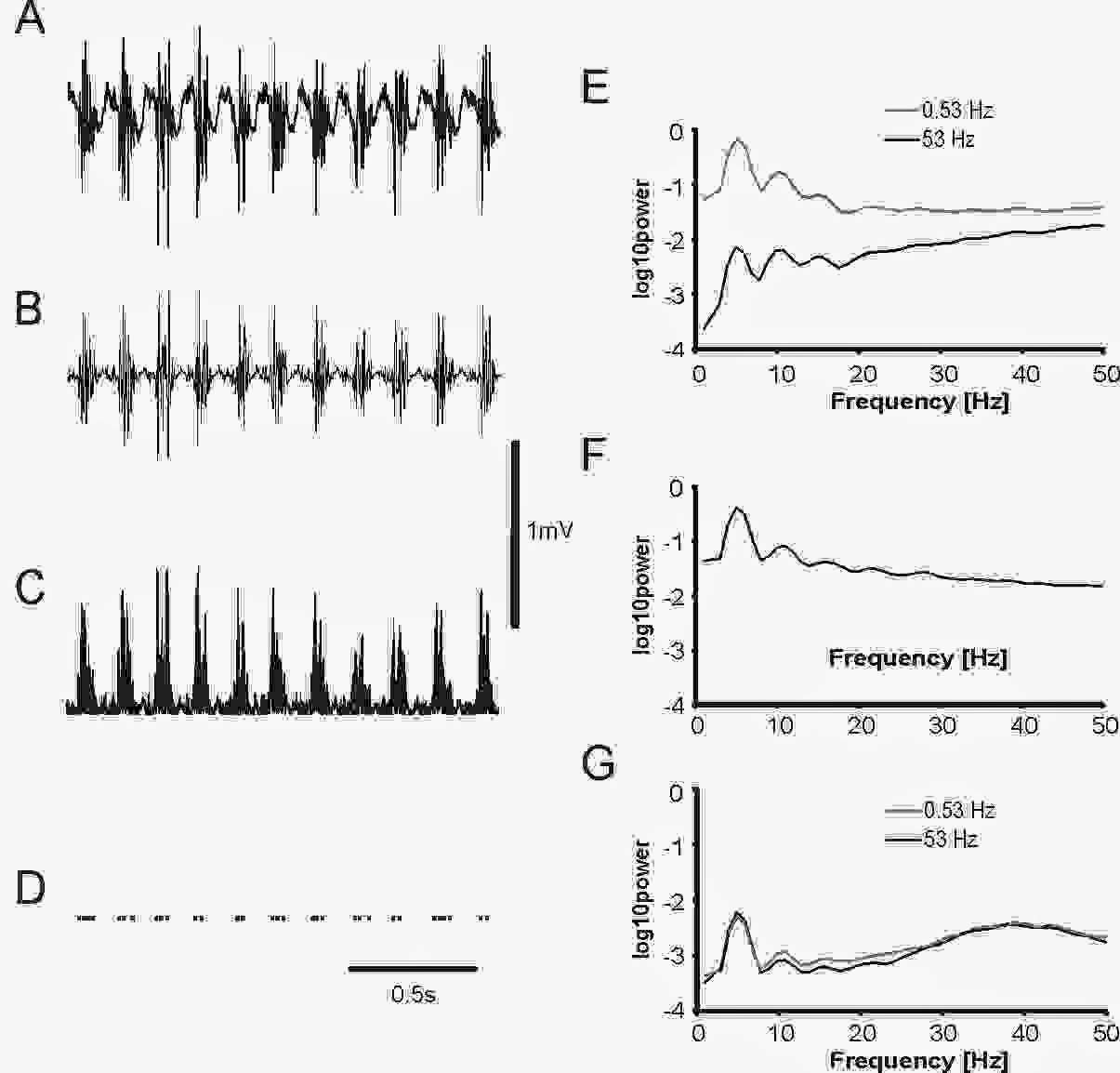 Biomecanica: ELECTROMIOGRAFÍA