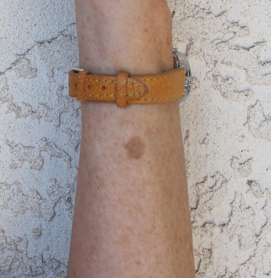 5 domowych sposobów na plamy wątrobowe