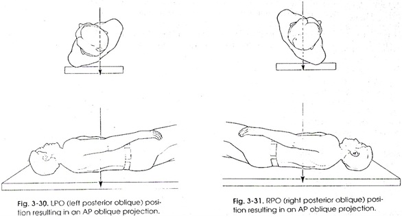 TEKNIK RADIOGRAFI DASAR - RADIOLOGI SCIENCES