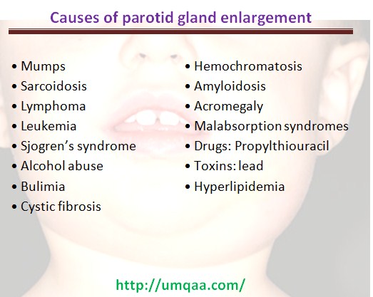 Parotid Gland Swelling Alcohol