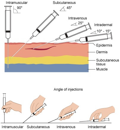 The Site for Healthcare Professionals: Infusion Pump