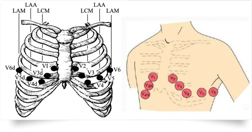 Amanecer Cada Día: ELECTROCARDIOGRAMA POSTERIOR Y DERECHO