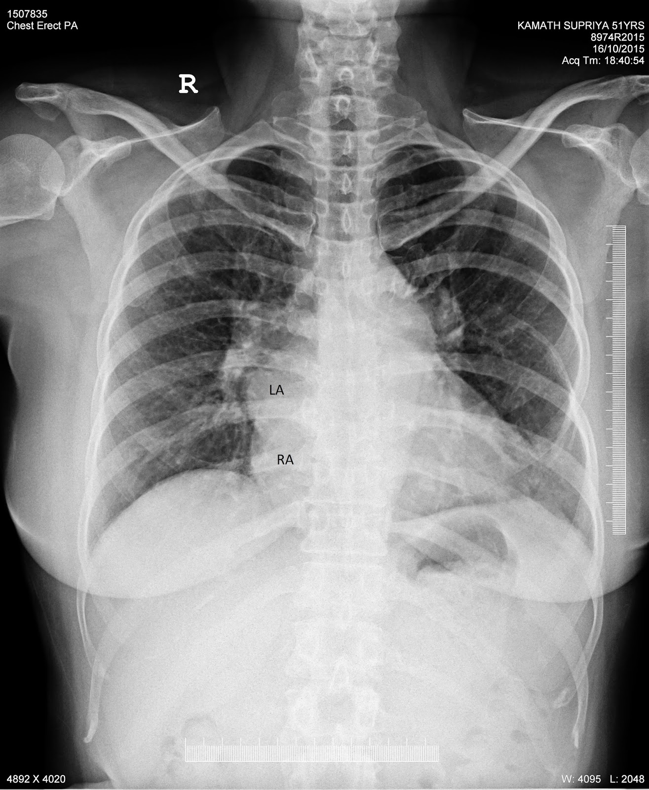 PPS Radiographs