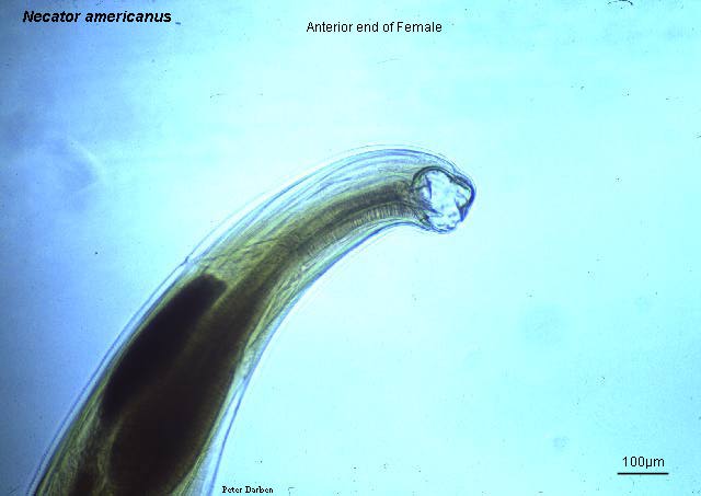 Necator_americanus ~ The WORLD