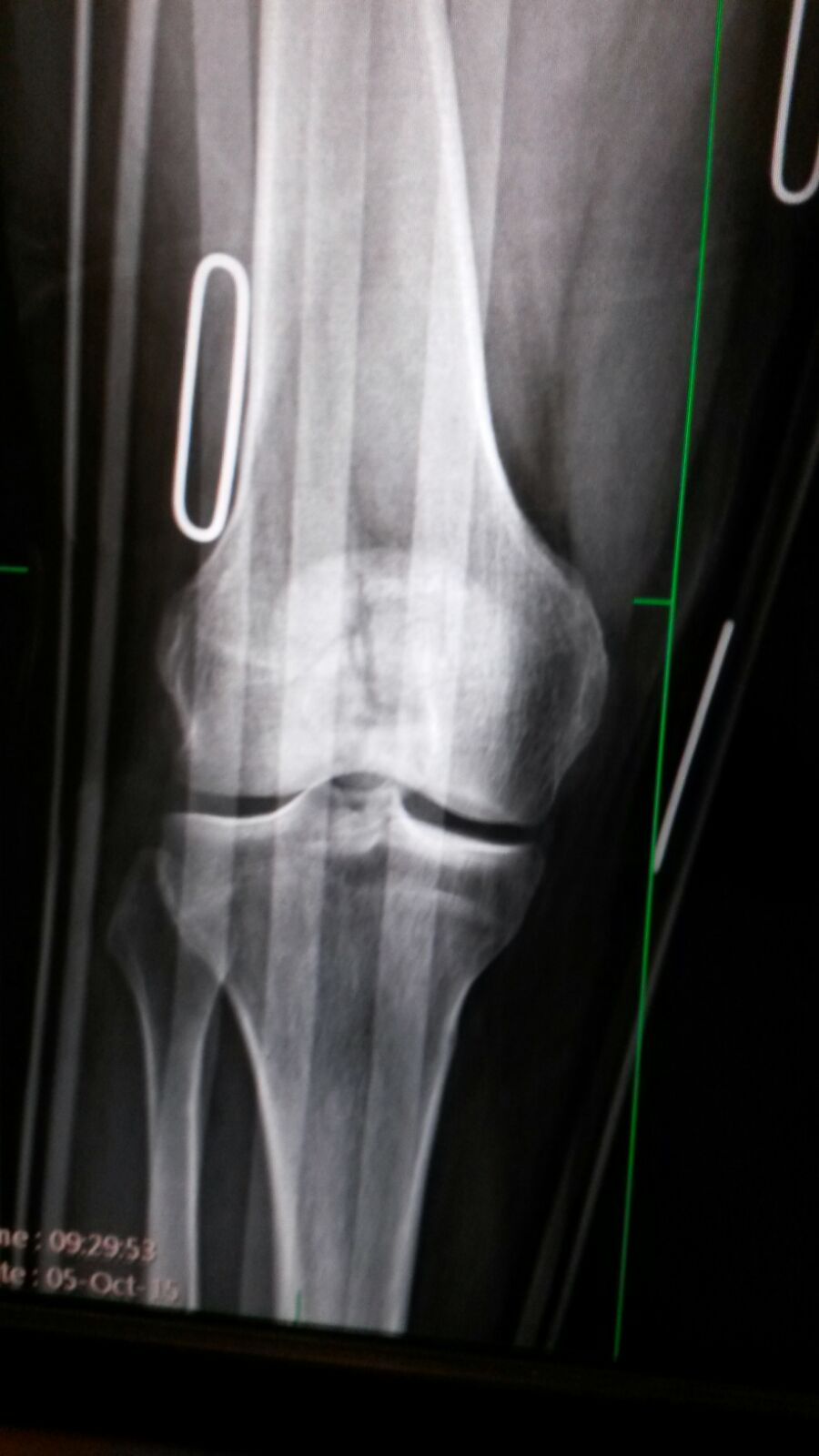 DICAS DE RADIOLOGIA - Tudo Sobre Radiologia: IMAGENS RADIOLÓGICAS ...