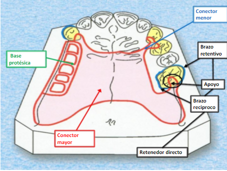 COMPONENTES DE UNA PROTESIS PARCIAL REMOVIBLE: noviembre 2015