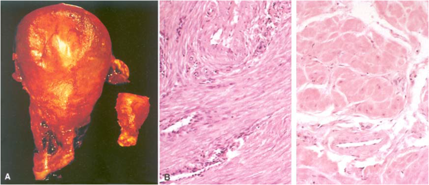 Docs Network: Cell Injury and Adaptation