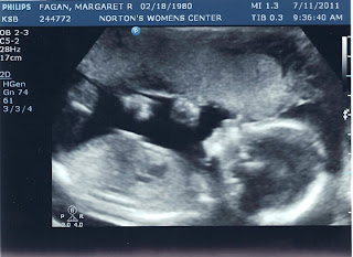 Baby Fagan 2011: 07/11/2011-5 Month Sonogram :)
