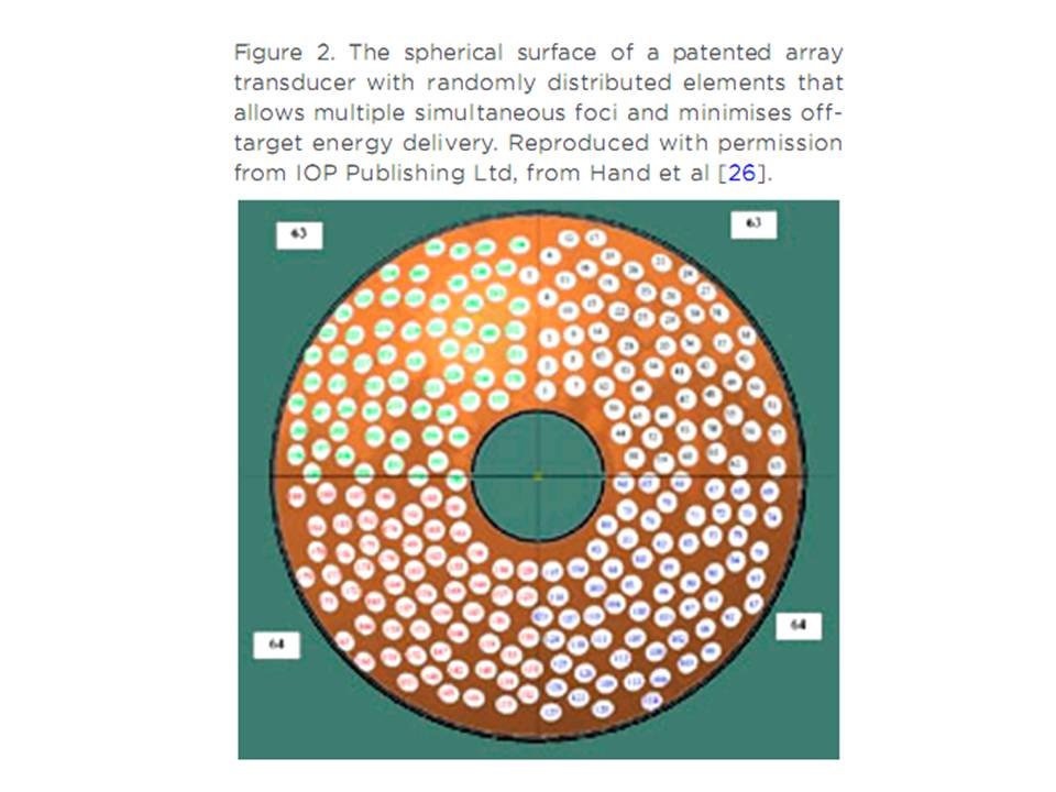 BÀI SOẠN VỀ SIÊU ÂM CHẨN ĐOÁN: HIFU in ONCOLOGY