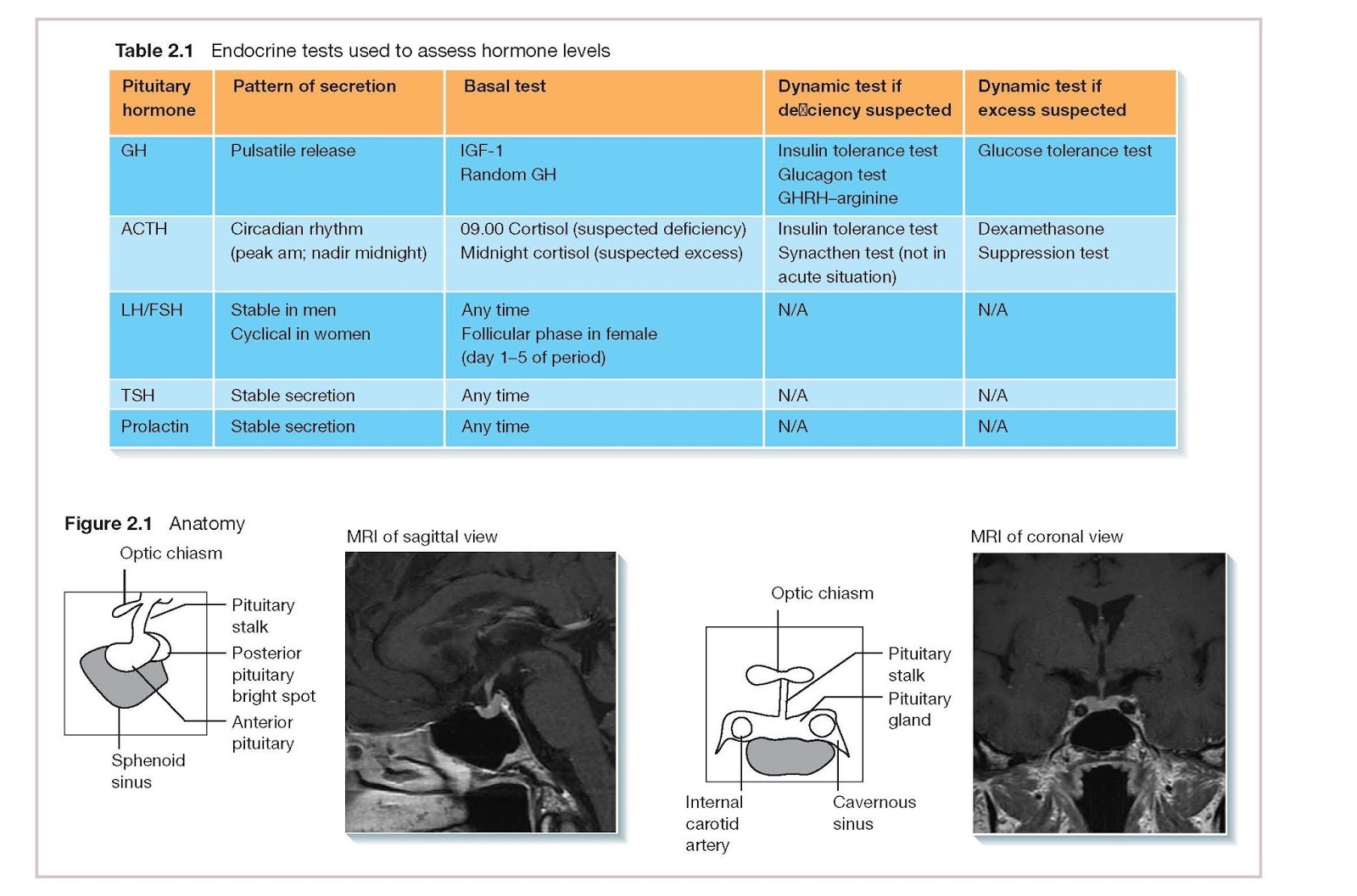 The Hypothalamic Pituitary Axis and Its Assessment - pediagenosis